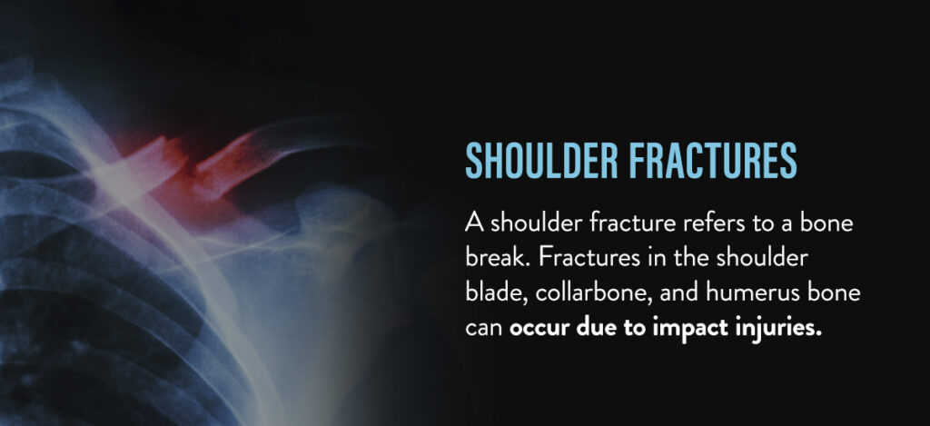 Shoulder Pain Causes and Risk Factors | New Orleans, LA